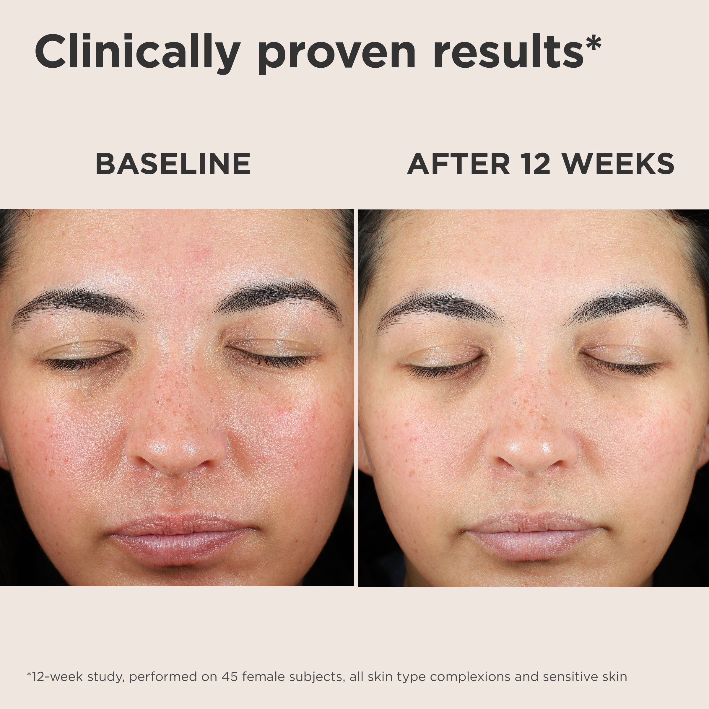 UV Skin Recovery Red Color Correcting Green Tint | Broad-Spectrum SPF ...